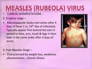 Paramyxoviruses lecture dwd | PPT