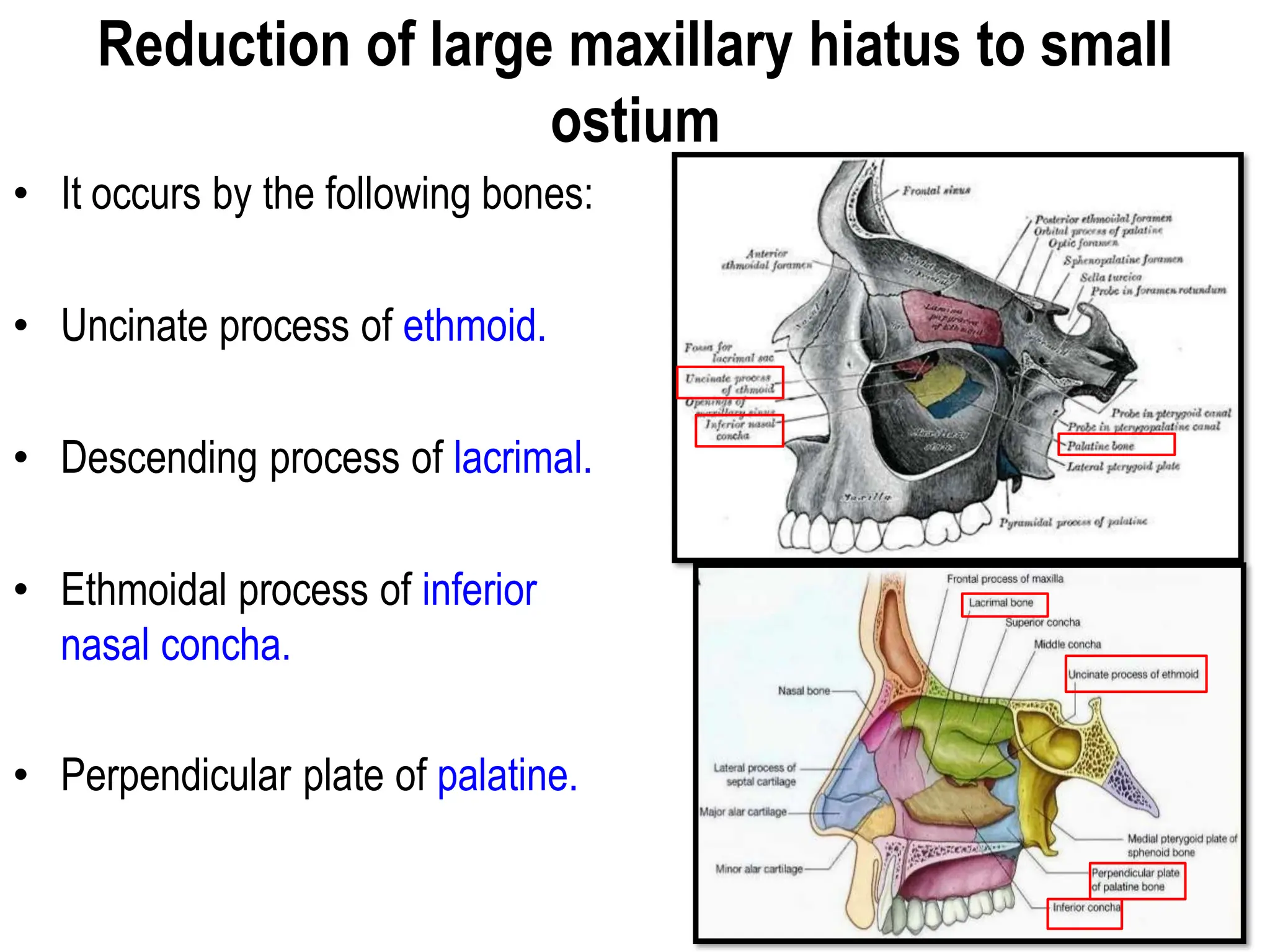 PARANASAL-AIR-SINUSES ethmoid, mastoidpdf | PDF
