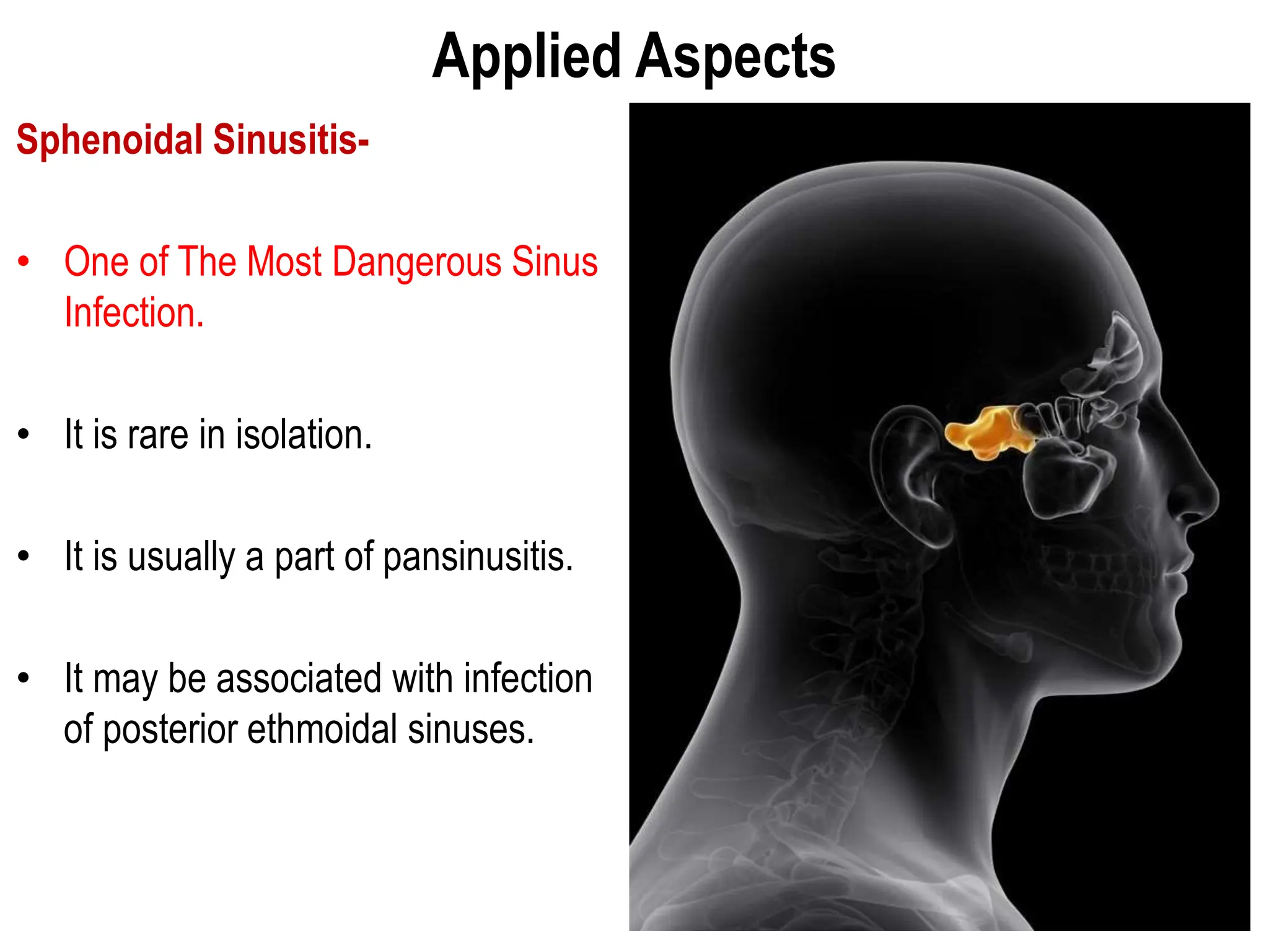 PARANASAL-AIR-SINUSES ethmoid, mastoidpdf | PDF