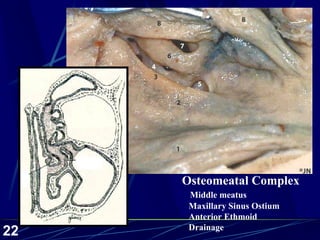 Paranasal sinus-2002-01-slides | PDF