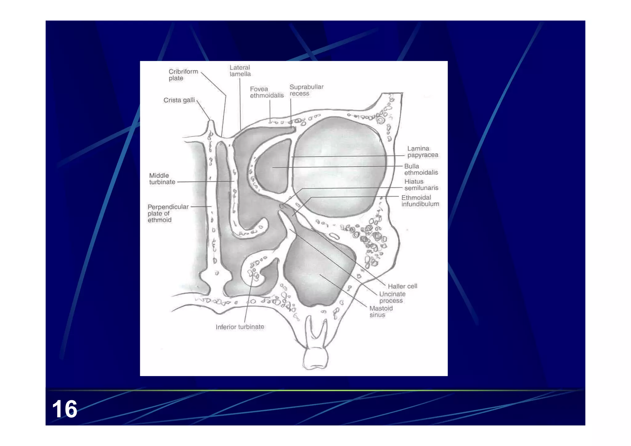 CT anatomy of the paranasal sinuses | PDF