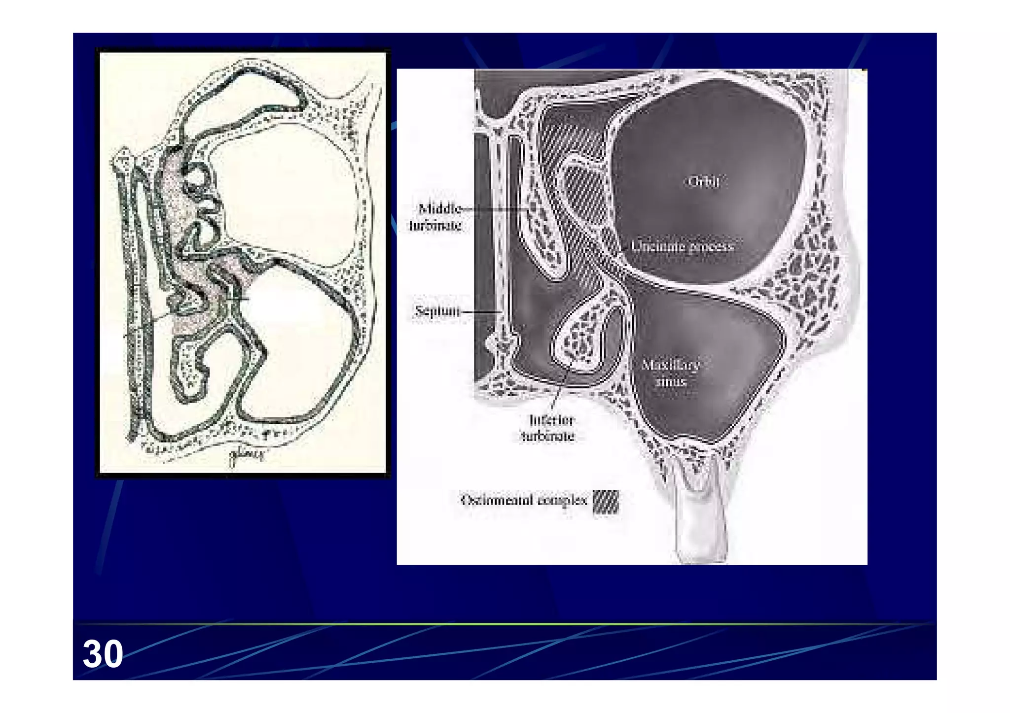CT anatomy of the paranasal sinuses | PDF