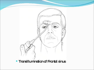 Paranasal Sinuses | PPT