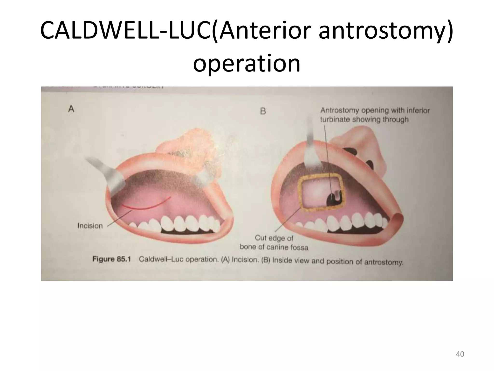 Paranasal air sinus | PPTX