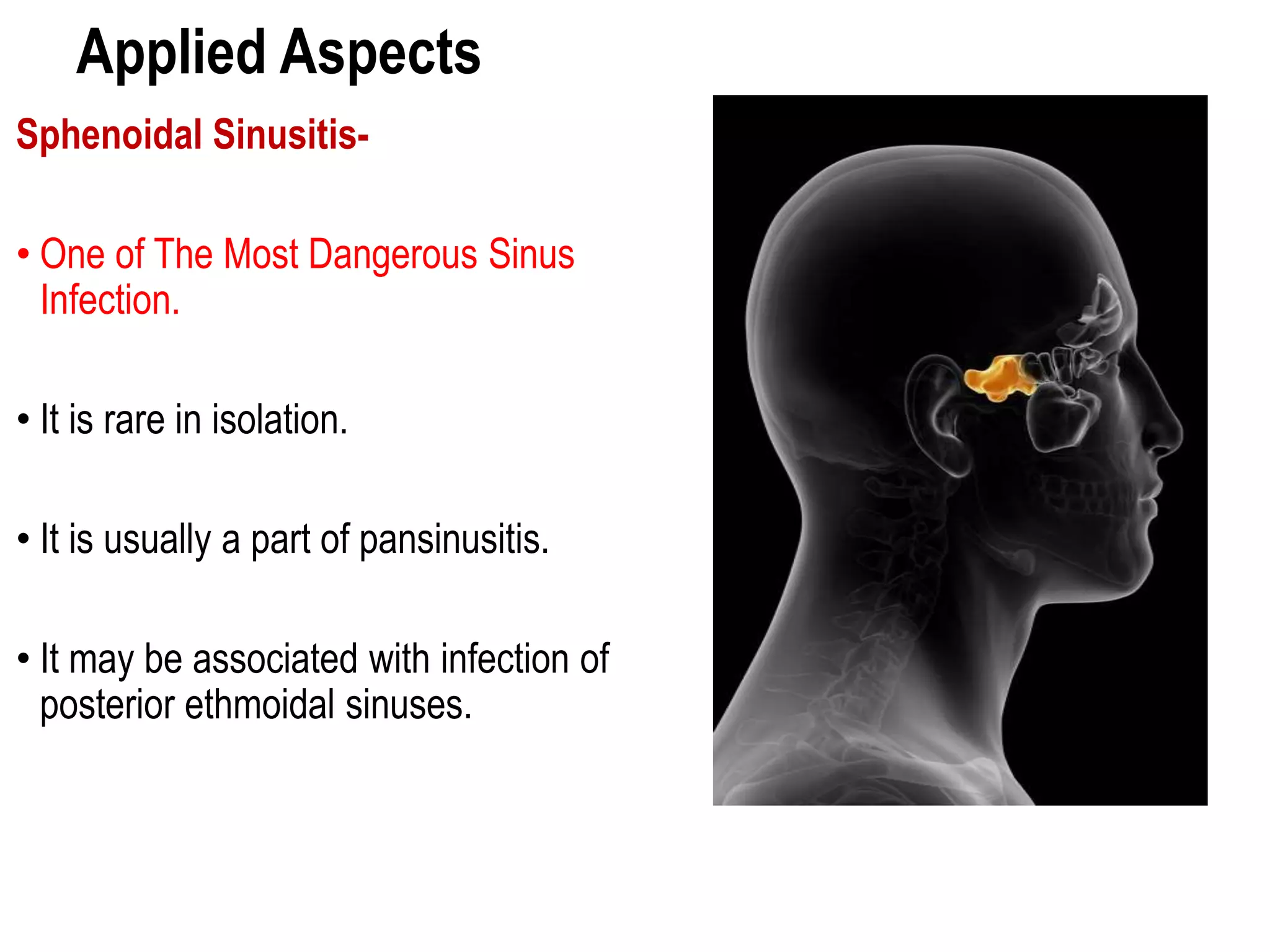 PARANASAL AIR SINUS.pptx | Ear, Nose and Throat Conditions | Diseases and Conditions