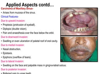 PARANASAL AIR SINUS.pptx
