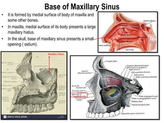 PARANASAL AIR SINUSES.pptx