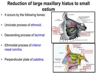 PARANASAL AIR SINUSES.pptx