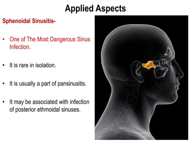 PARANASAL AIR SINUSES.pptx