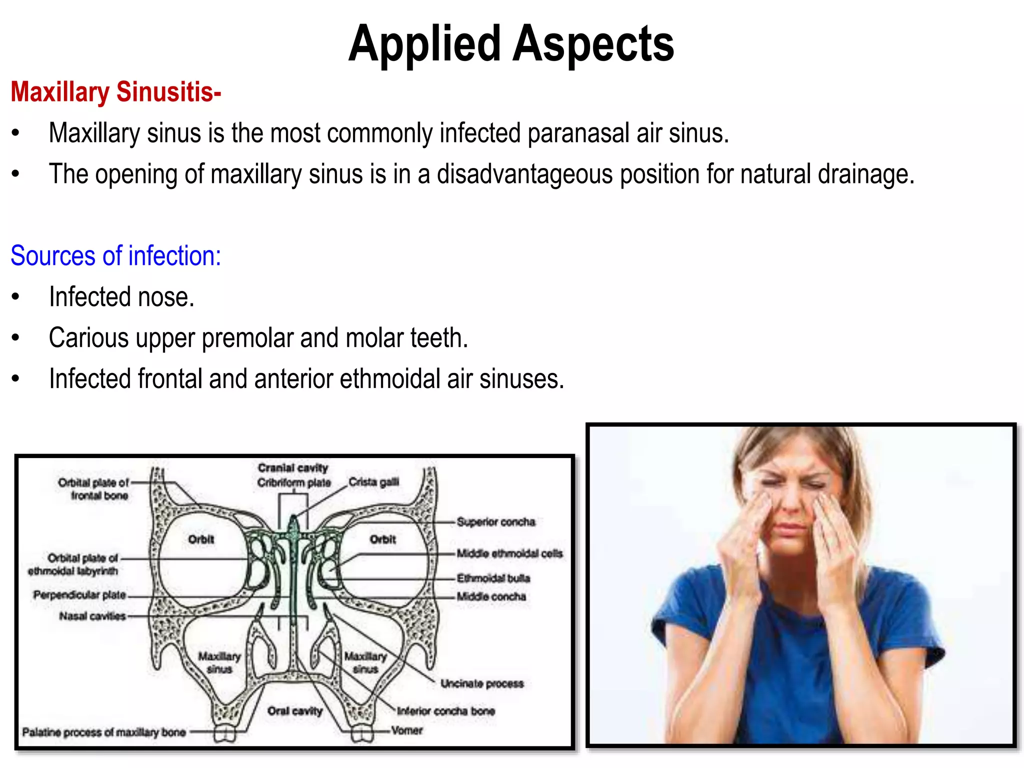 paranasal_air_sinuses.pptx