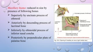 Paranasal Air Sinuses present in human skull | PPTX