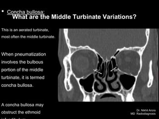 Paranasal sinuses .pptx
