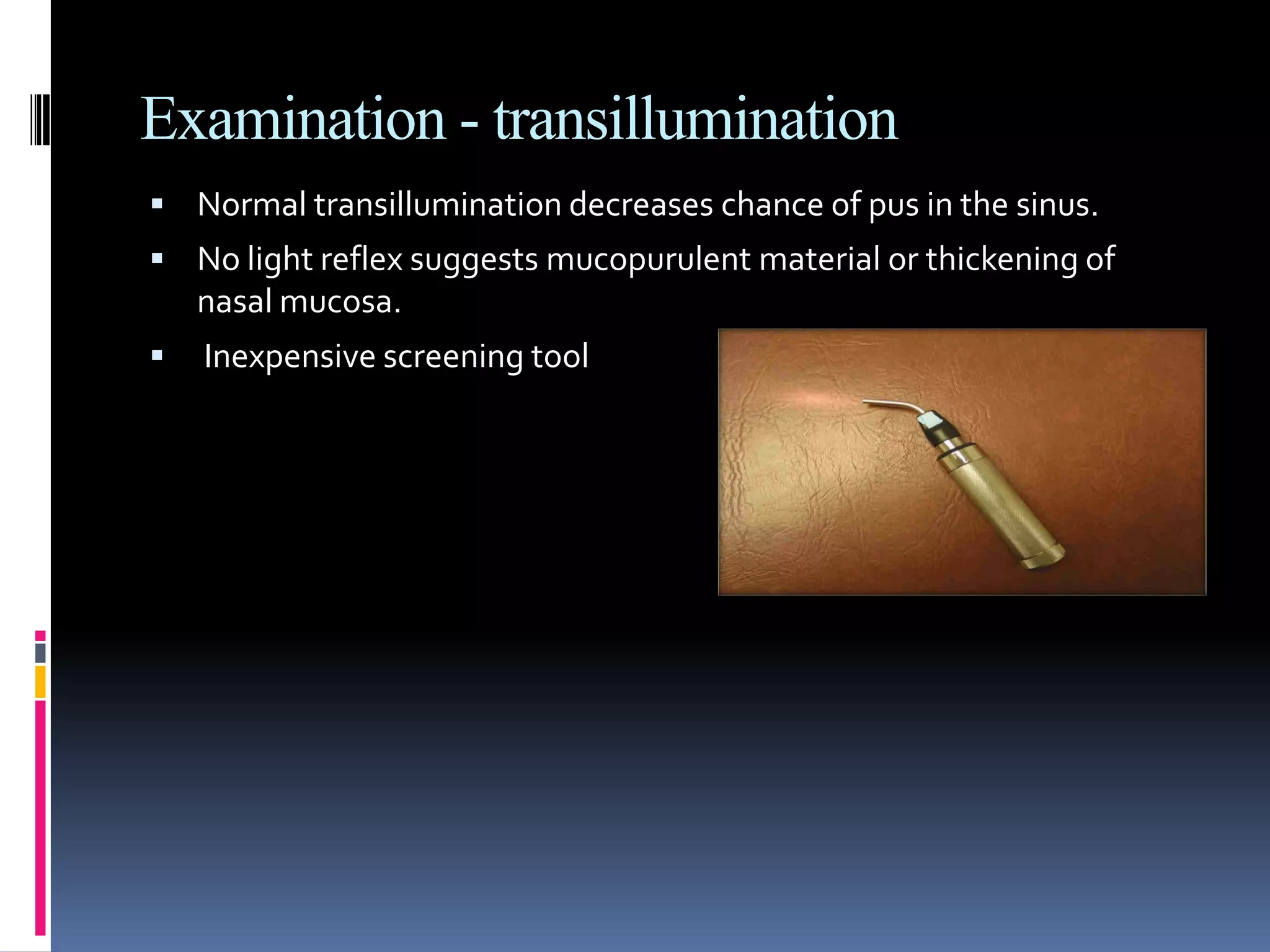 Paranasalsinuses | PDF
