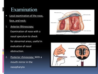 Paranasalsinuses | PDF