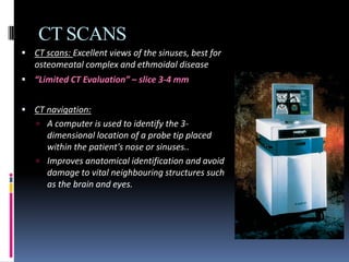 Paranasalsinuses | PDF