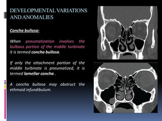Paranasalsinuses | PDF