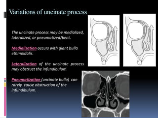 Paranasalsinuses | PDF