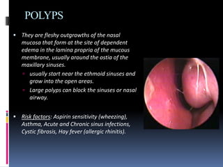 Paranasalsinuses | PDF