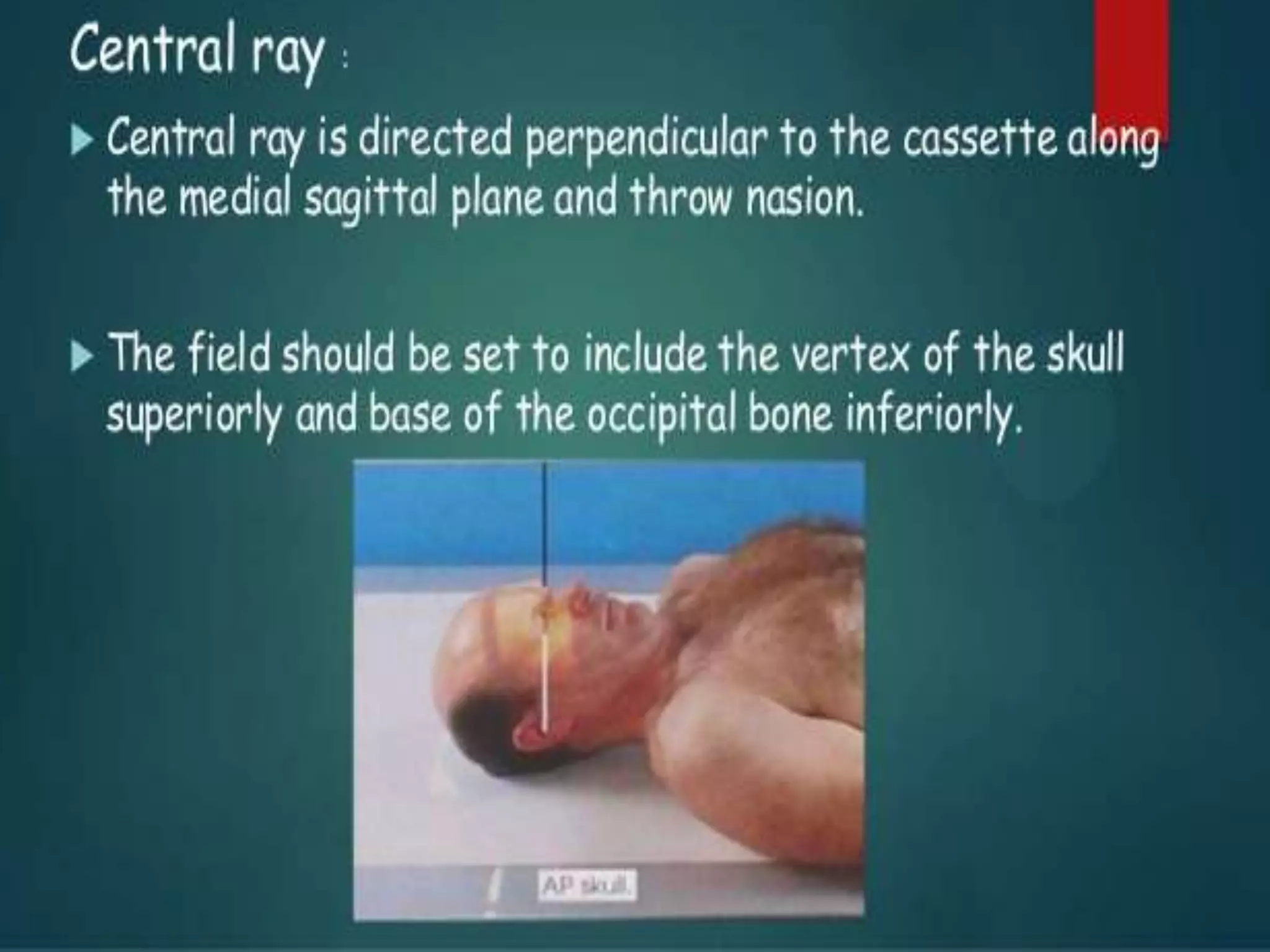 X-Ray skull & Paranasal sinuses | PPT