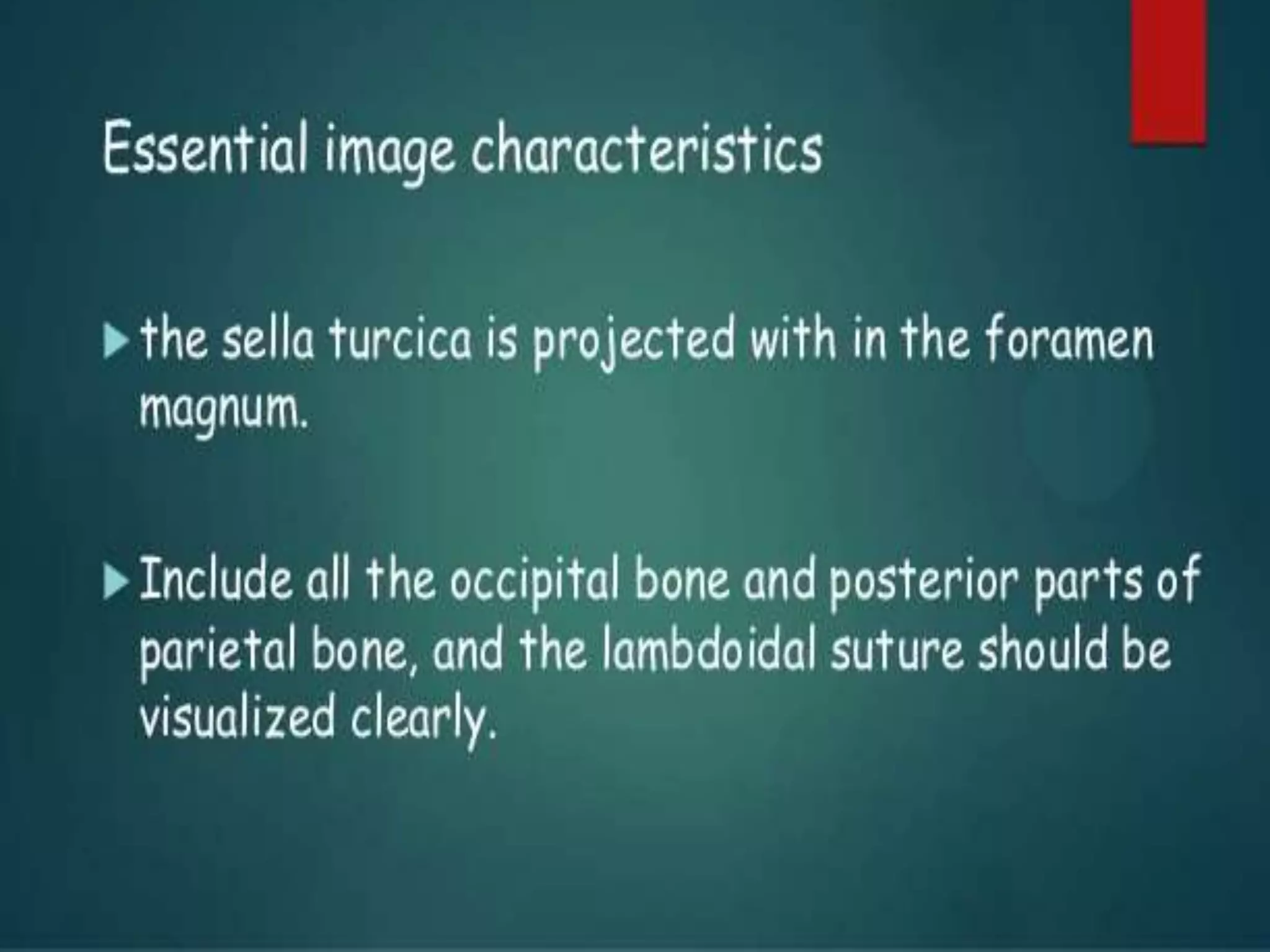 X-Ray skull & Paranasal sinuses | PPT
