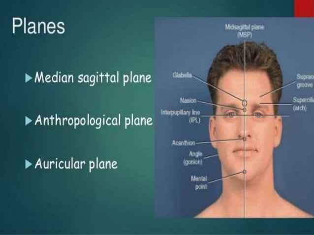 X-Ray skull & Paranasal sinuses | PPTX