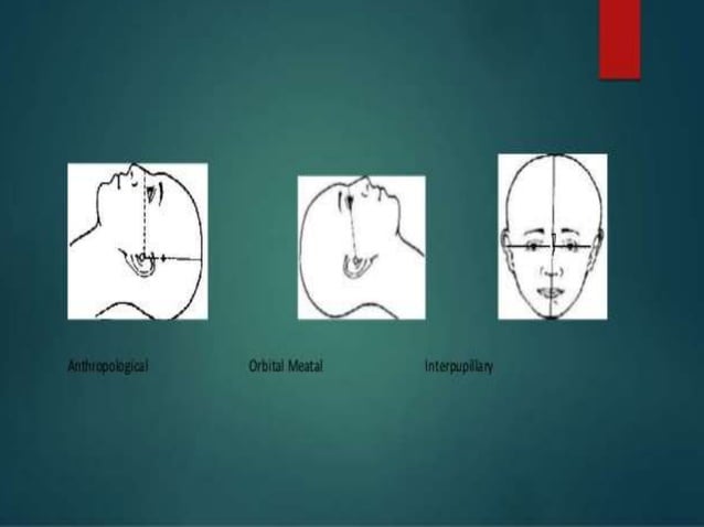 X-Ray skull & Paranasal sinuses | PPTX