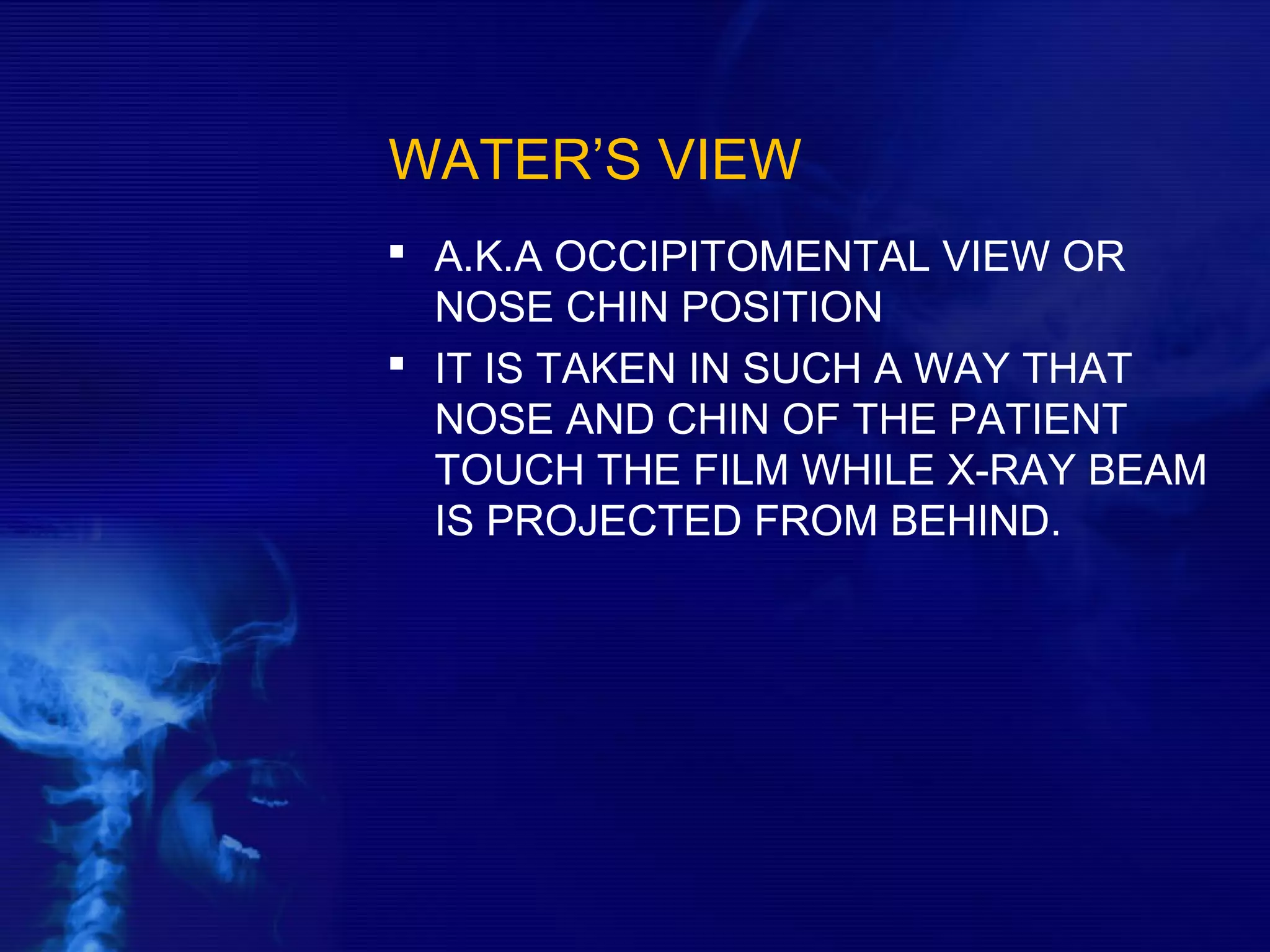 Paranasal sinuses anatomy and pathology dr ashok | PPT