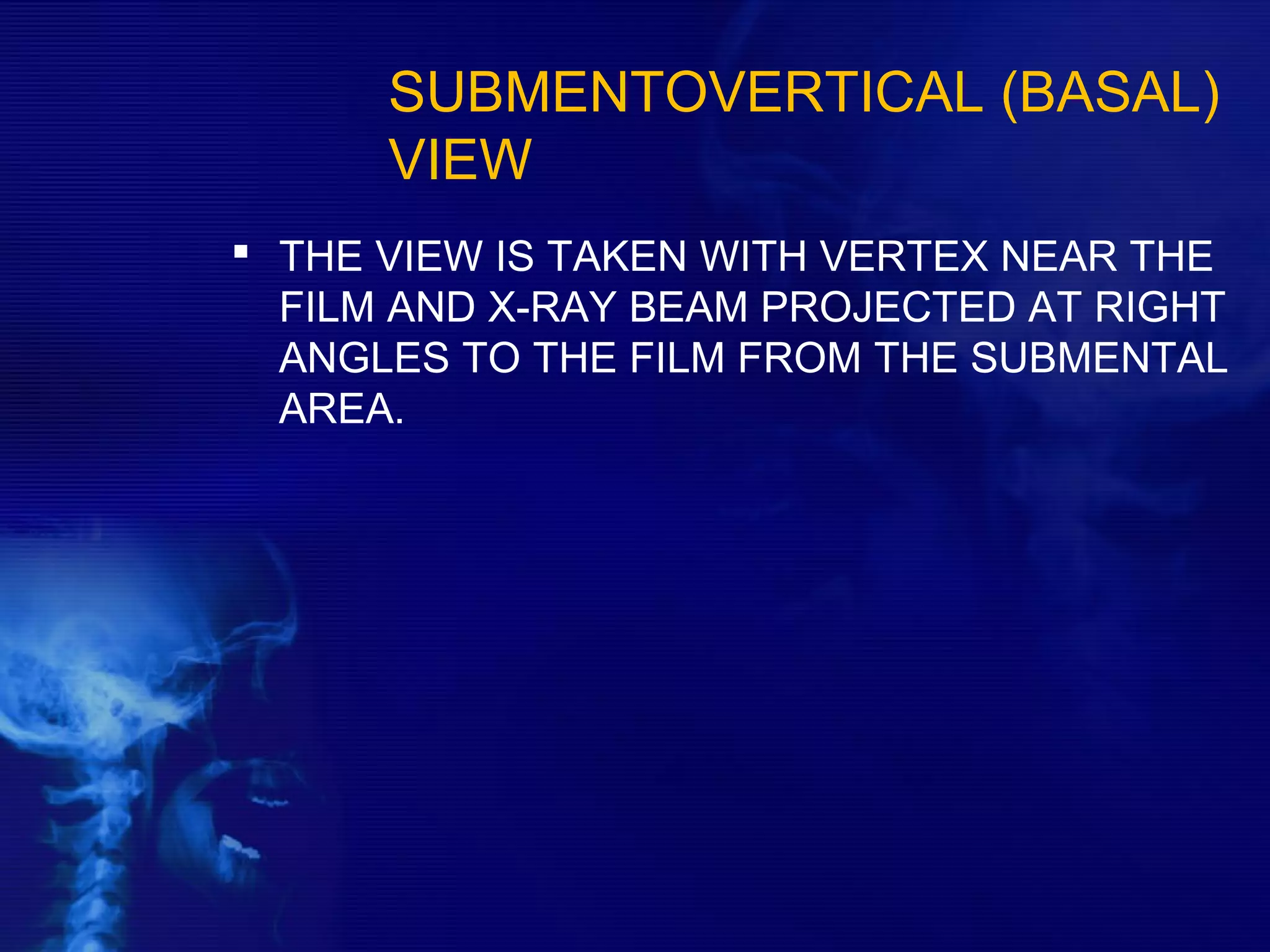 Paranasal sinuses anatomy and pathology dr ashok | PPT