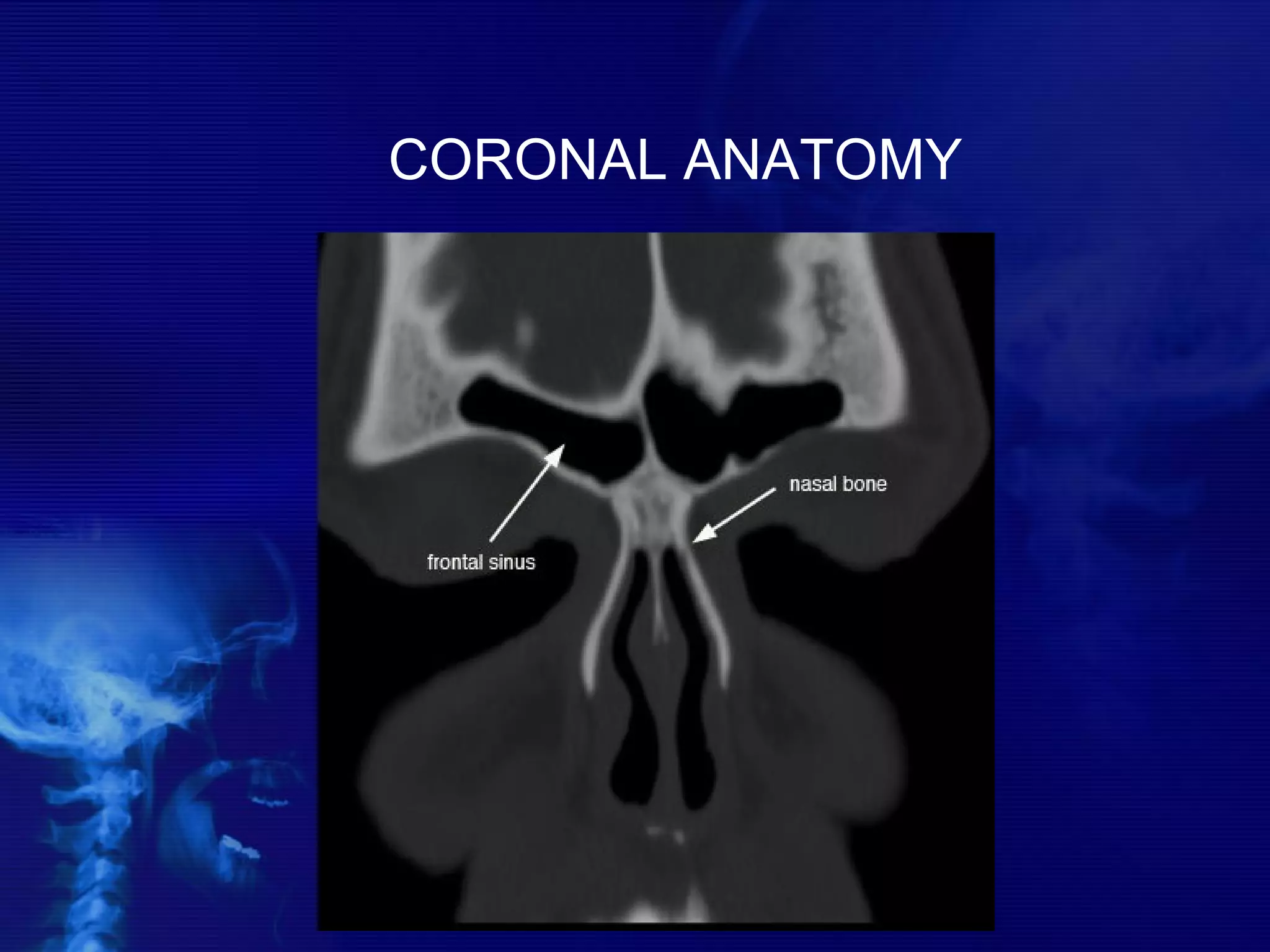 Paranasal sinuses anatomy and pathology dr ashok | PPT