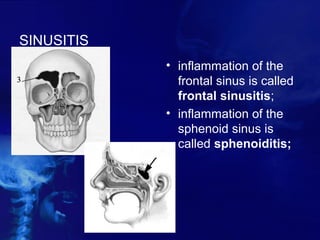 Paranasal sinuses anatomy and pathology dr ashok | PPT