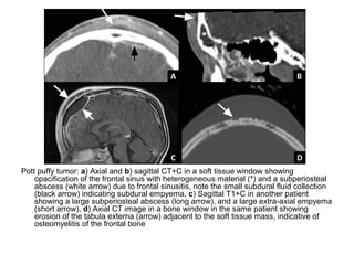 Diagnostic Imaging of Paranasal sinuses and Nose | PPT