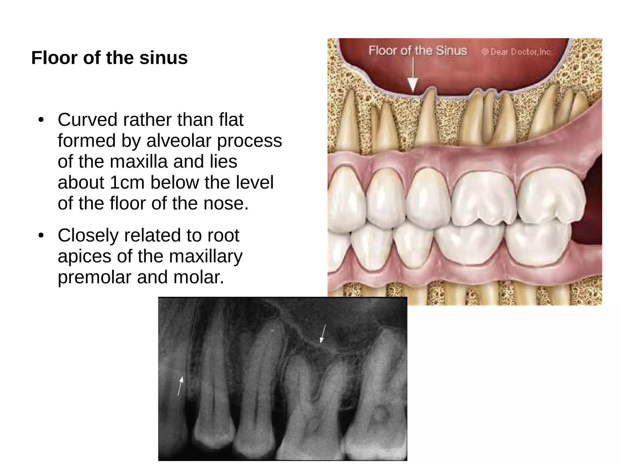 Paranasal sinuses | ODP