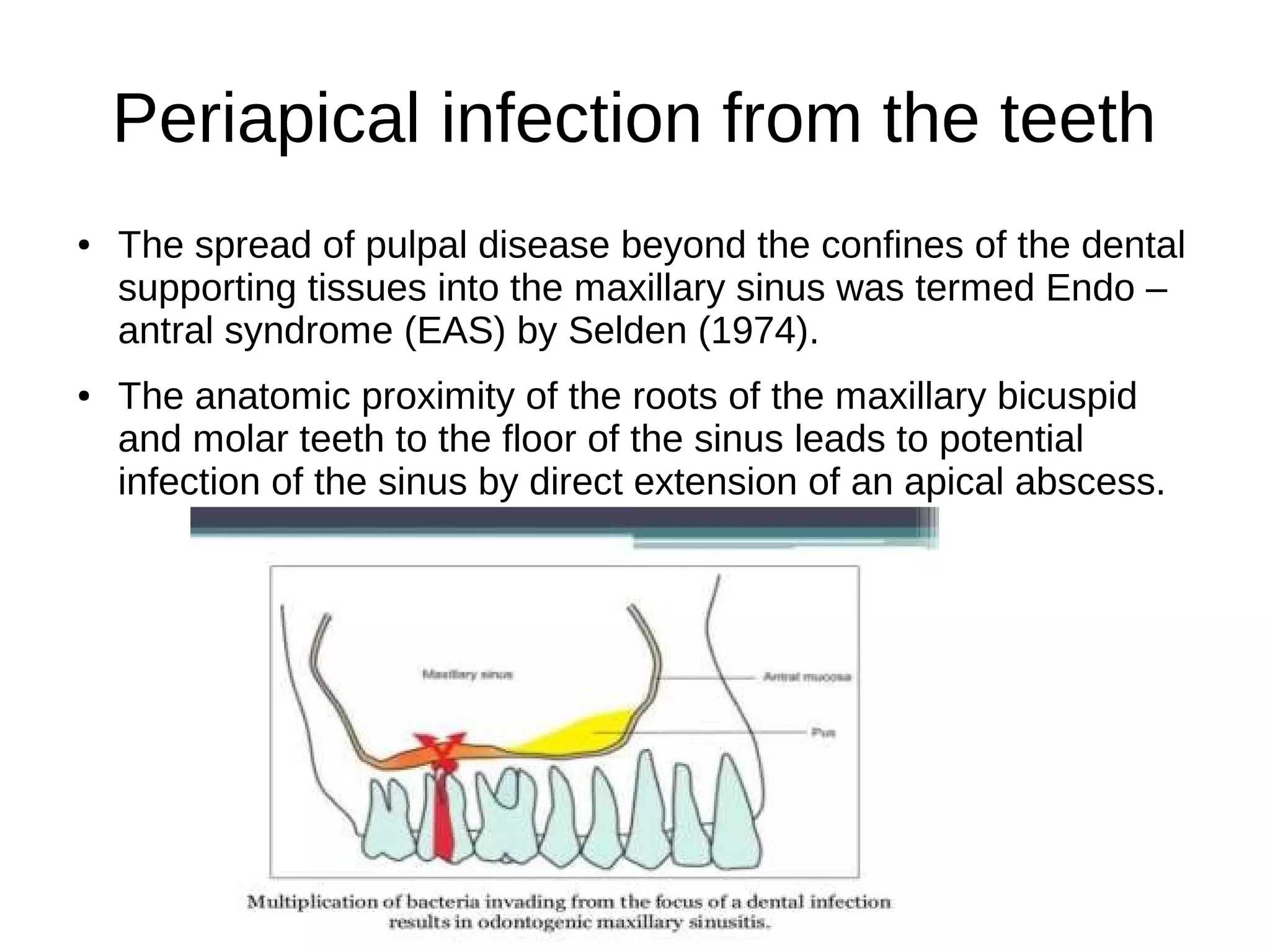 Paranasal sinuses | ODP
