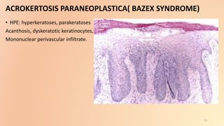 Paraneoplastic dermatoses | PPTX
