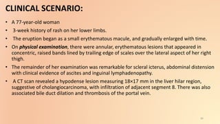 Paraneoplastic dermatoses | PPTX