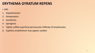 Paraneoplastic dermatoses | PPTX