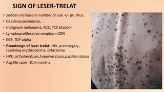 Paraneoplastic dermatoses | PPT