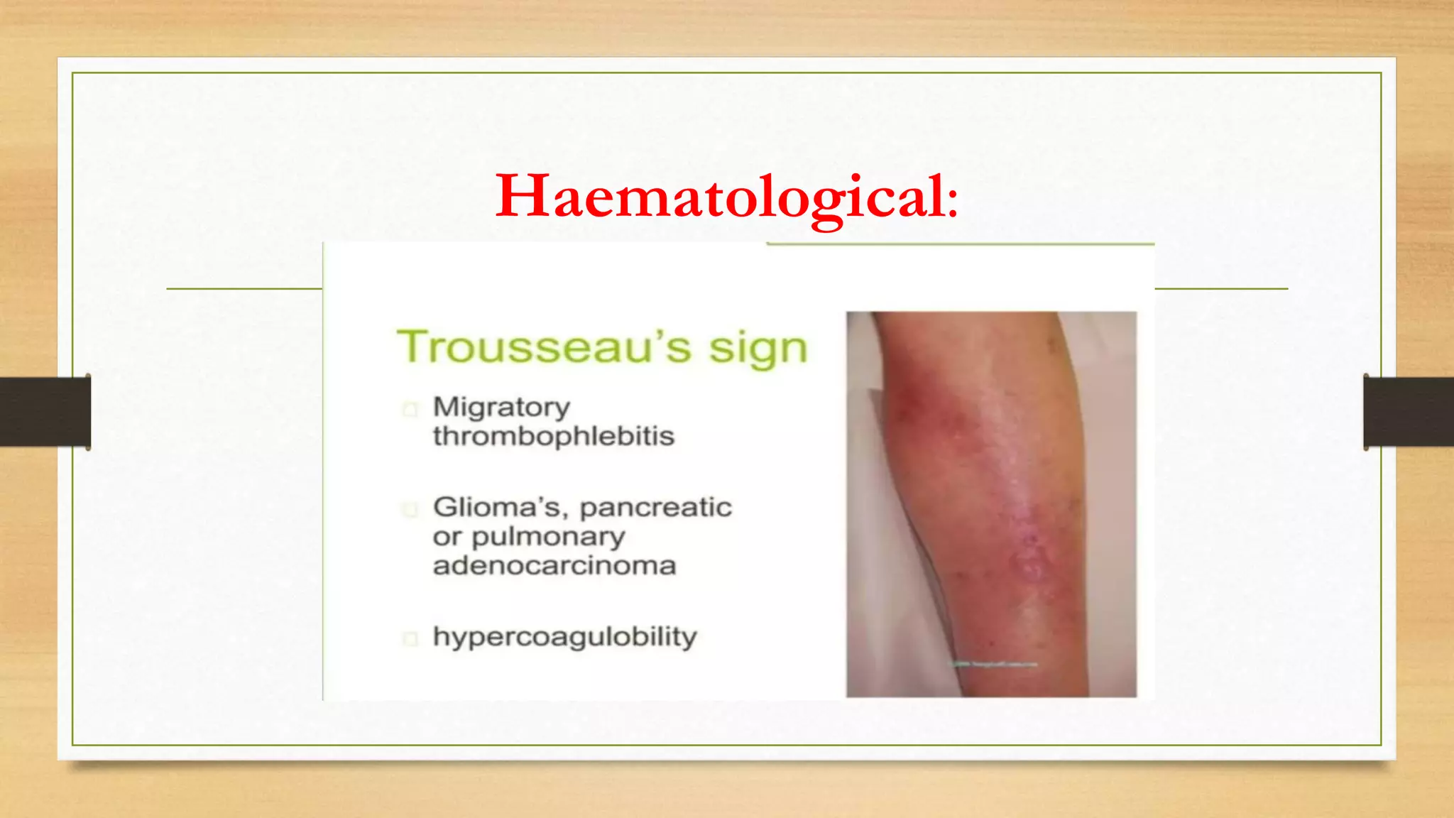 Paraneoplastic Syndrome.pptx
