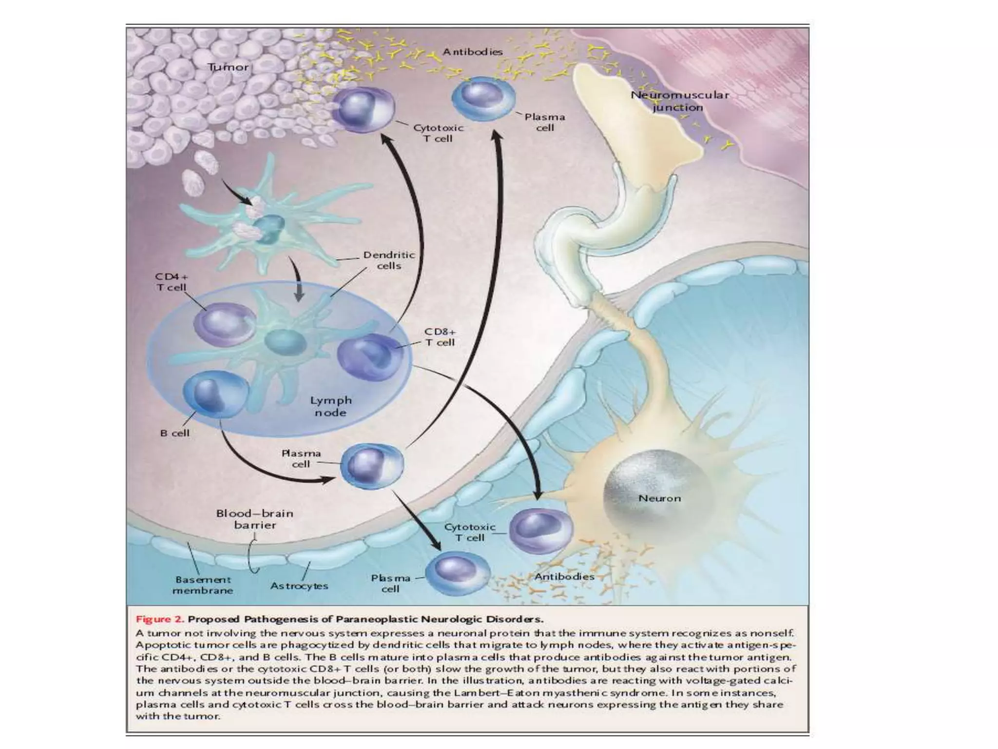 Paraneoplastic syndromes - CNS manifestations | PPTX