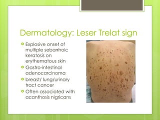 paraneo plastic syndromes patholaogy.pptx