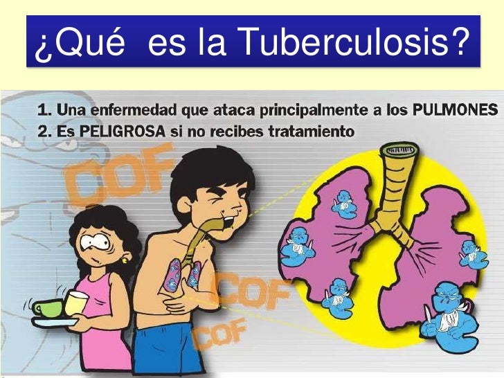 Tuberculosis nivel medio