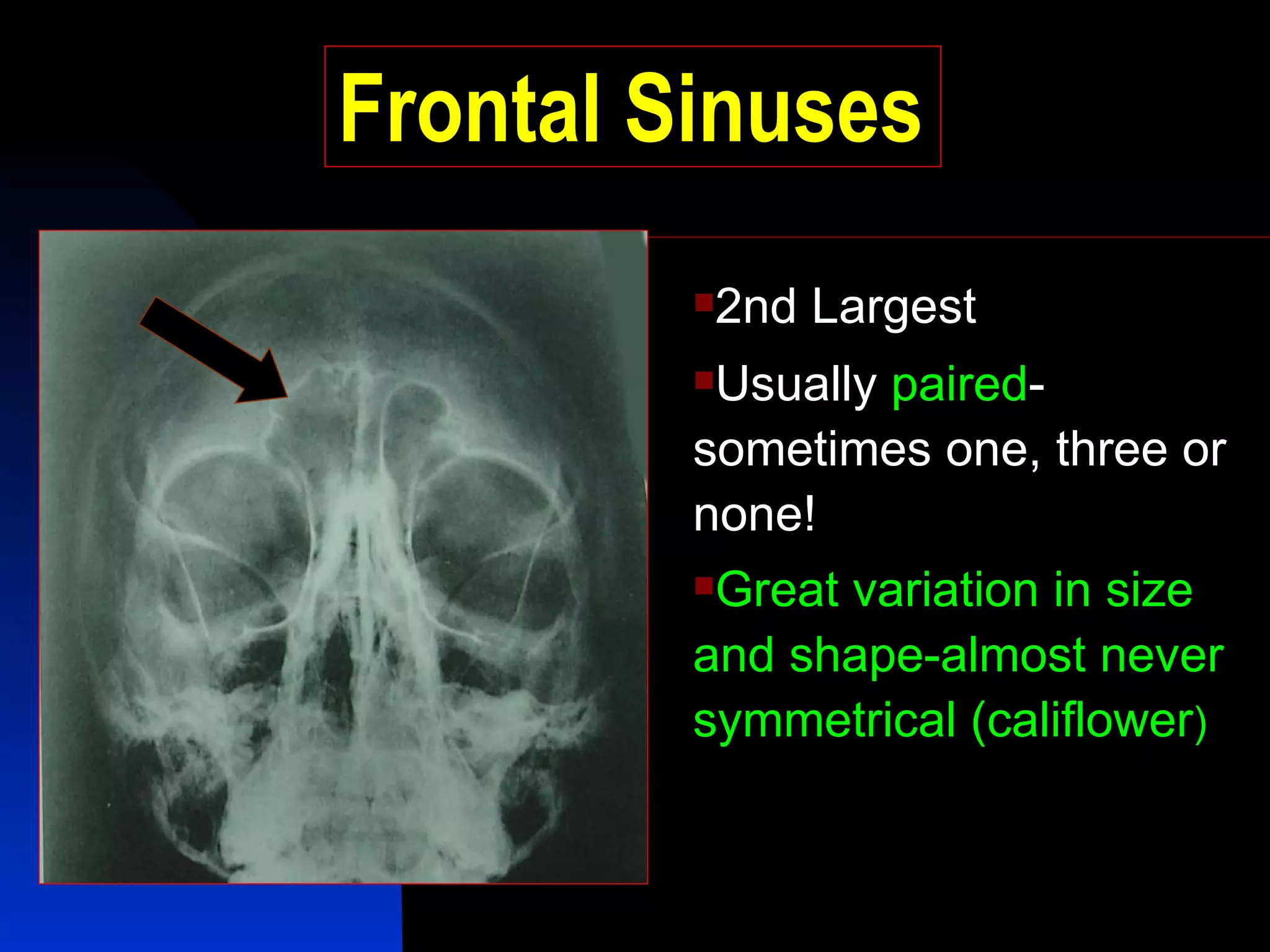 Paransasal Sinuses Home Edition | PPT
