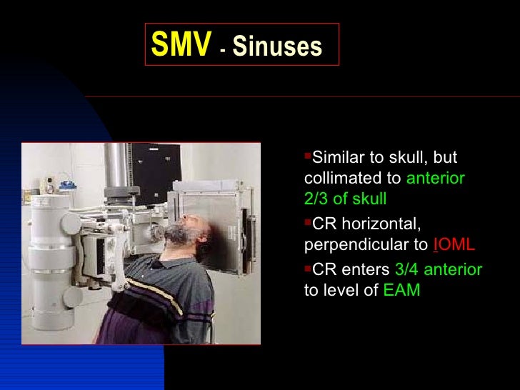 Paransasal Sinuses Home Edition