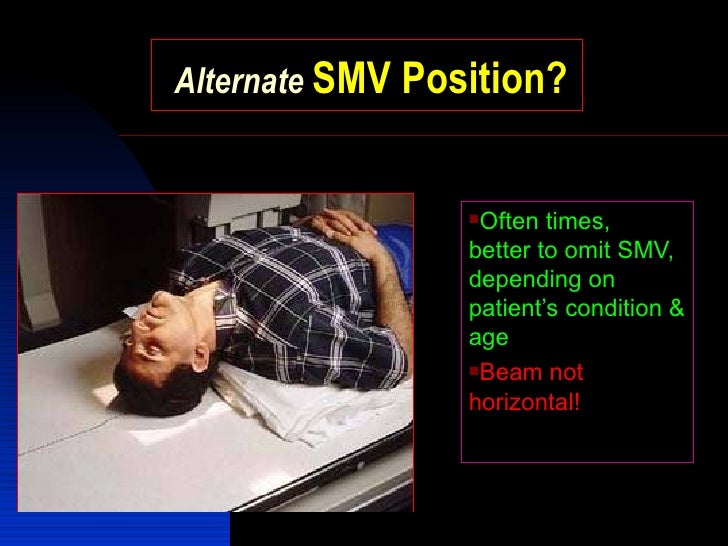 Paransasal Sinuses Home Edition