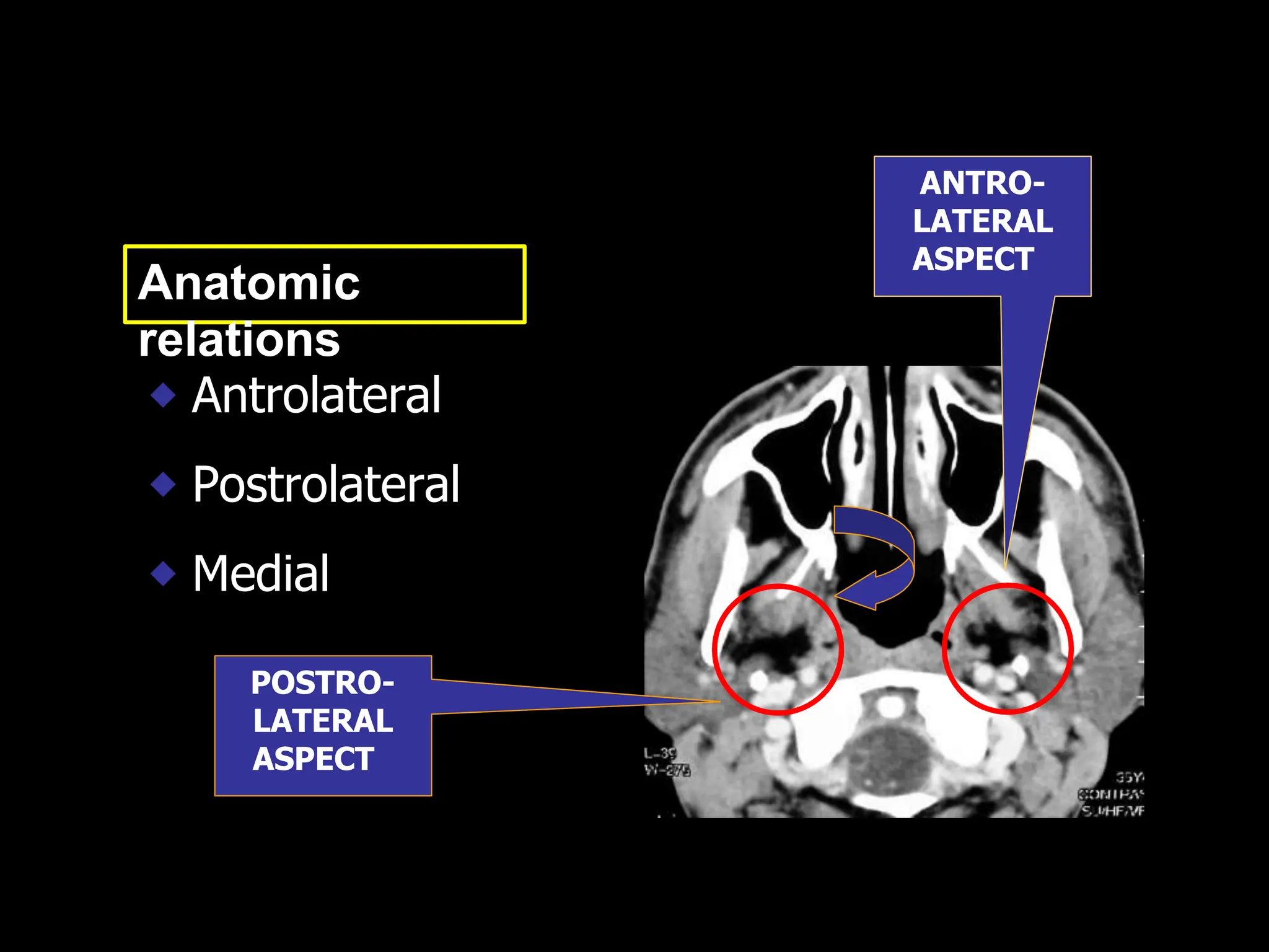 ALL ABOUT DETALED DESCRIPTION Parapharyngeal-spaces.pptx