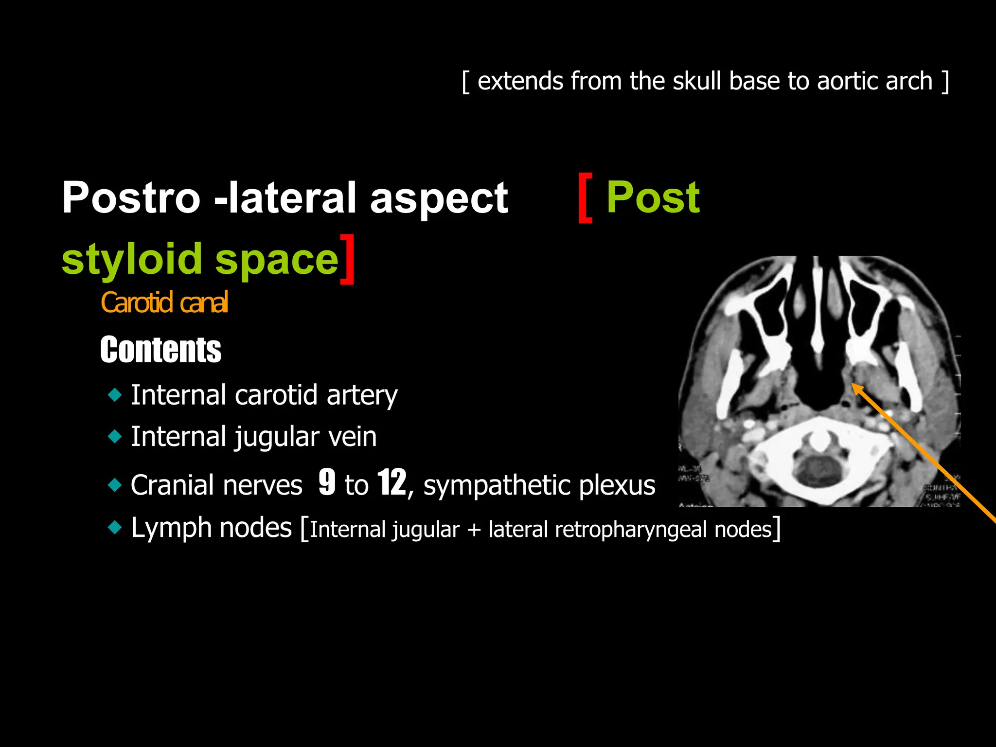 ALL ABOUT DETALED DESCRIPTION Parapharyngeal-spaces.pptx
