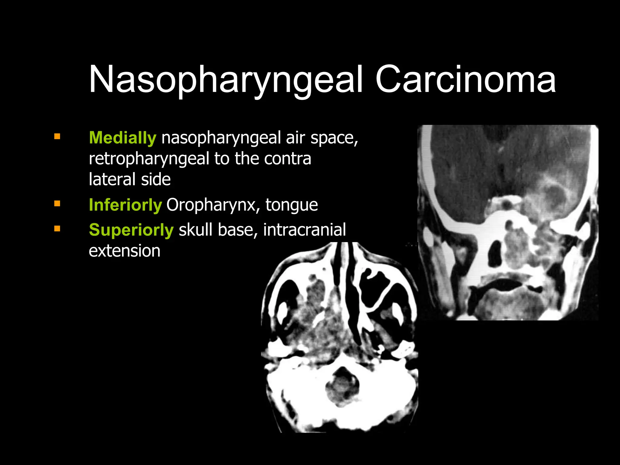 ALL ABOUT DETALED DESCRIPTION Parapharyngeal-spaces.pptx