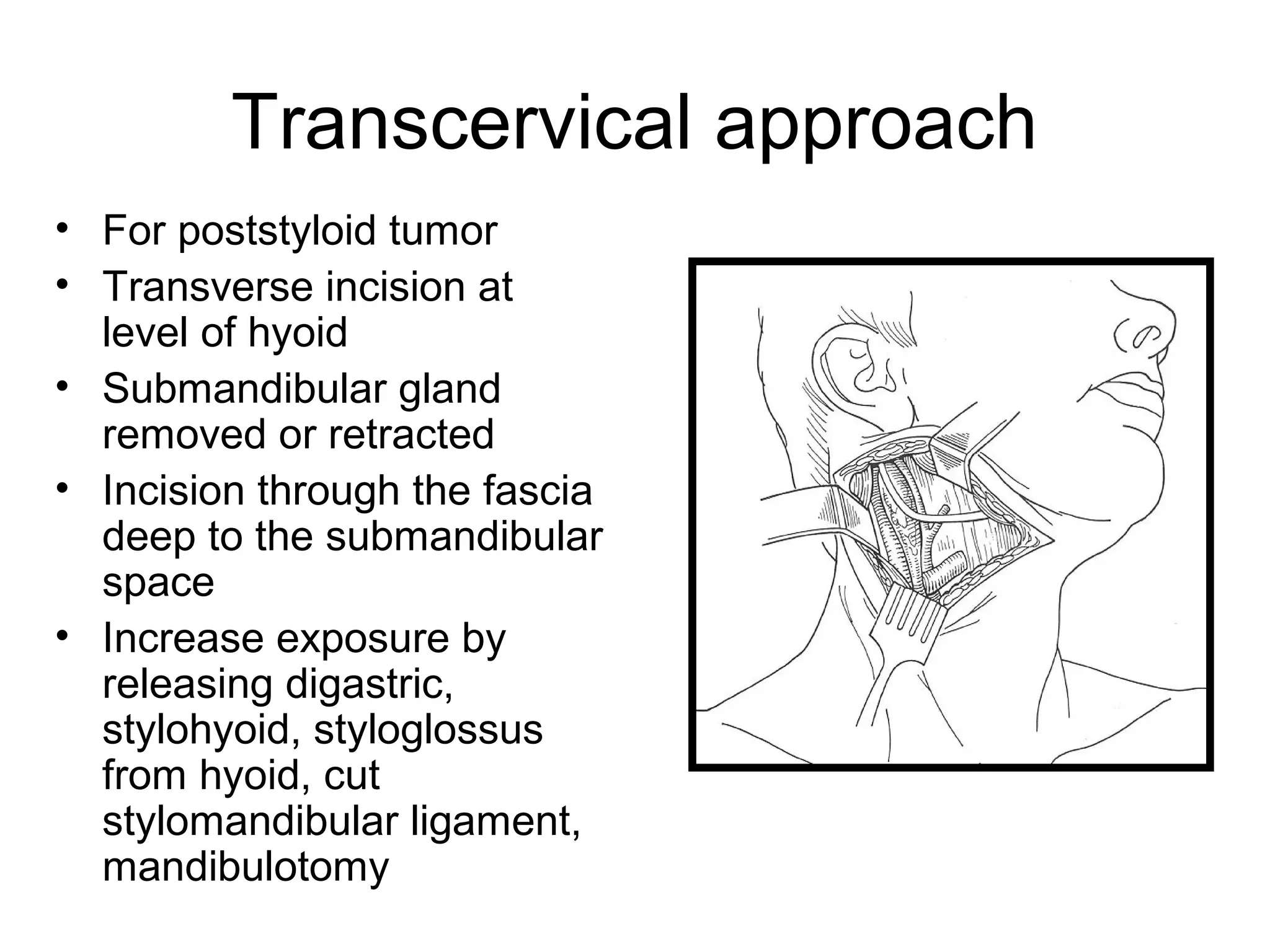 Parapharyngeal tumors ug - 01.08.2016 - prof.s.gobalakrishnan | PPT