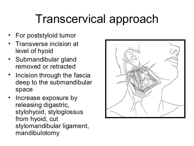 Parapharyngeal tumors ug - 01.08.2016 - prof.s.gobalakrishnan