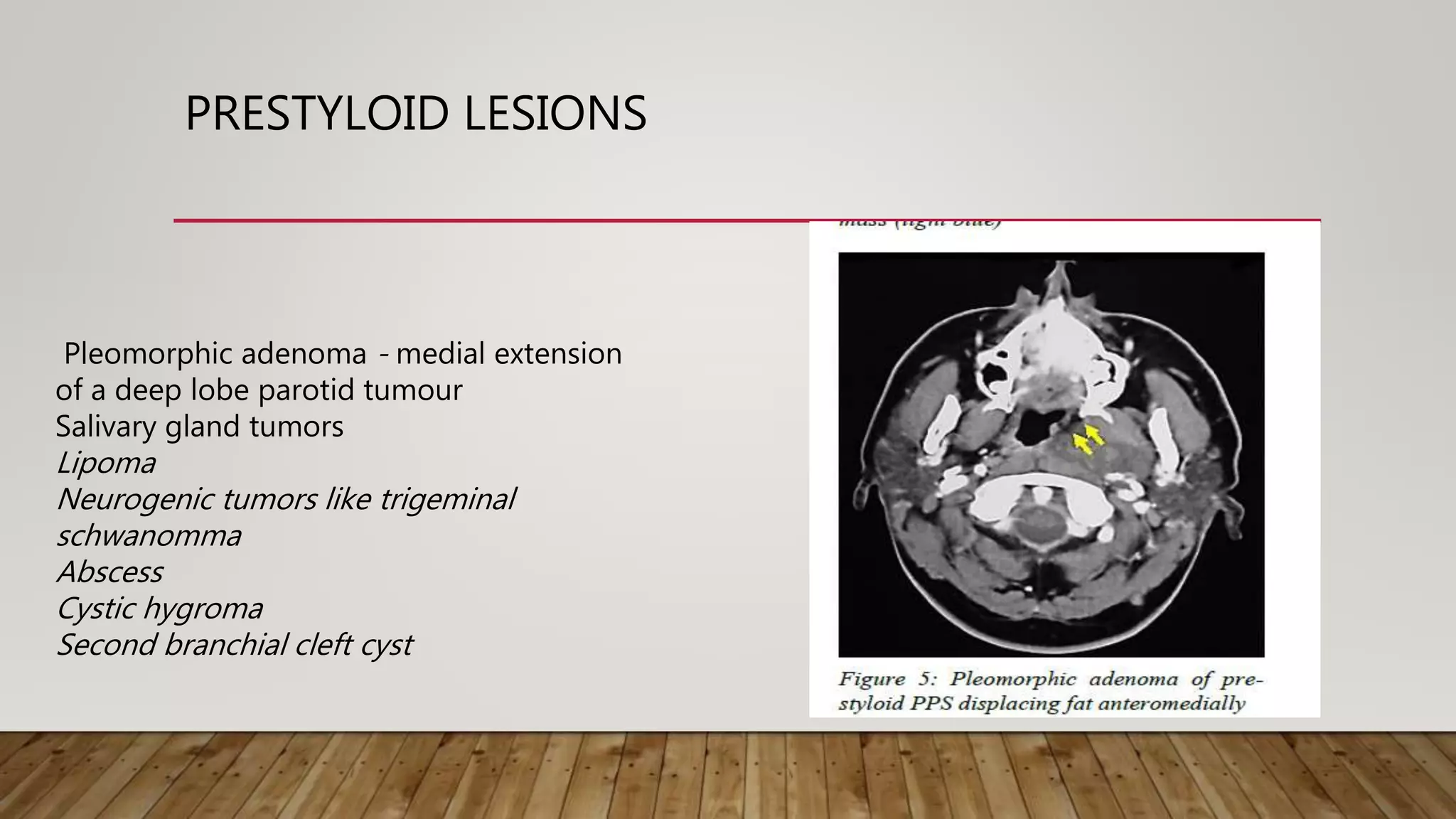 Parapharyngeal space | PPTX